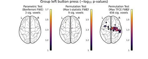 massively univariate analysis of a motor task from the localizer
