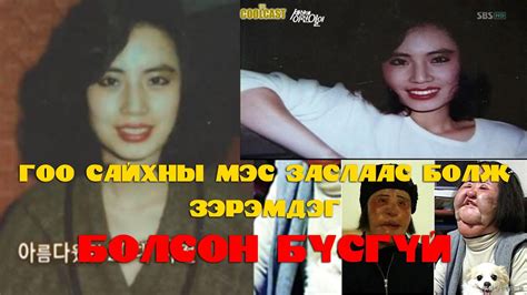 Гоо сайхны мэс заслаас болж эрэмдэг болсон бүсгүй Youtube