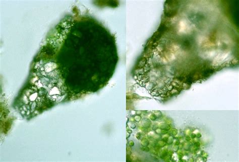 Protist Images Difflugia Pyriformis