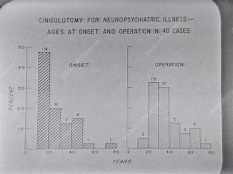 Cingulotomy For Chronic Neuropsychiatric Illness 1965 Stock Video Clip K011 6250 Science