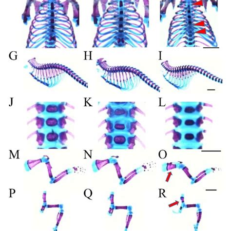 Skeletal Development In Runx2 And Runx2 Newborn Mice A B