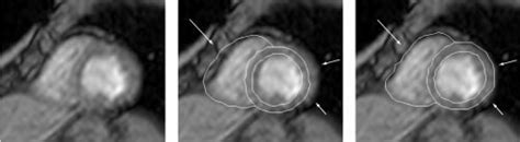 Comparison Of Conventional Aam And Multistage Hybrid Asm Aam Download Scientific Diagram
