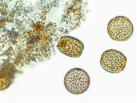 Can We Produce New Medicines From Microalgae