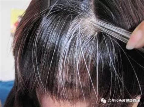 小孩为什么也会有白头发，你知道吗？ 知乎