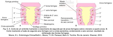Bolsas Faringeas Faringe O Que é Embriologia E Anomalias