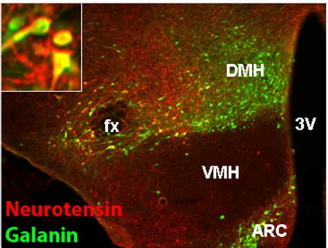 Figure 2 From The Lateral Hypothalamus As Integrator Of Metabolic And Environmental Needs From