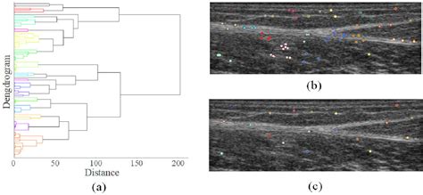 Figure 4 From Automatic Myotendinous Junction Identification In