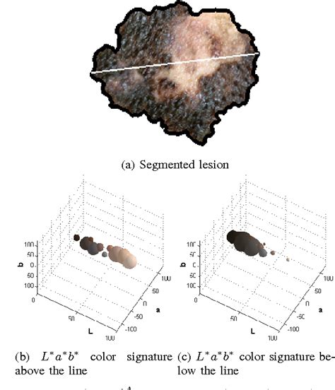 Figure 1 From High Level Intuitive Features Hlifs For Intuitive Skin Lesion Description