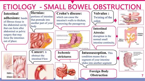 Bowel Obstruction Pptx