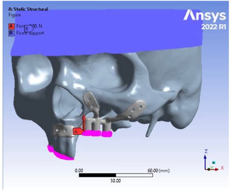 Boundary Condition Under Typical Loading Condition 300 N Download