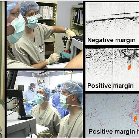 Third Generation Intraoperative Portable Oct System And Handheld Probe
