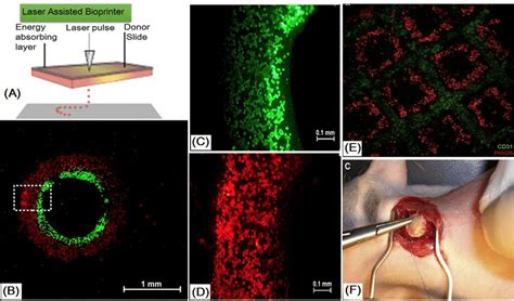 Laser Based Bioprinting Method A A Schematic Of Laser Assisted