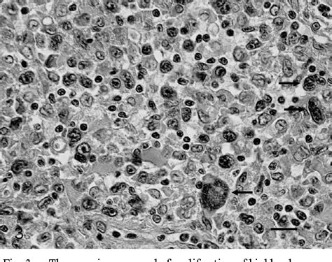 Figure 1 From Histiocytic Sarcoma In The Brain Of A Cat Semantic Scholar