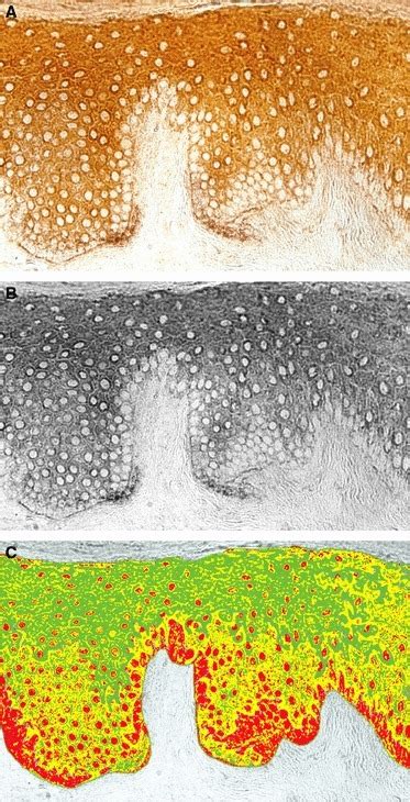 A Standard Skin Transient Receptor Potential Vanilloid 1 Trpv1 Download Scientific Diagram