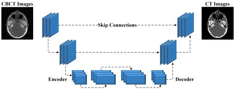 논문 리뷰 Synthetic Ct Image Generation From Cbct A Systematic Review