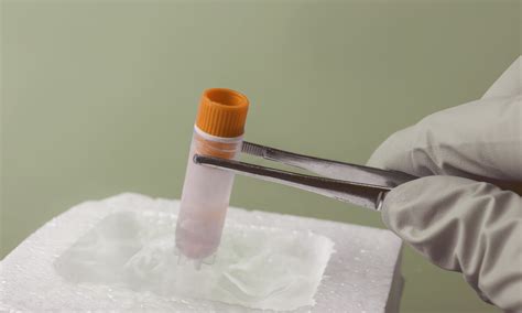 Social Sperm Freezing Preserving Male Fertility