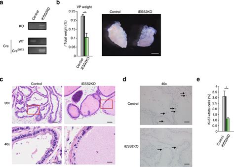 Ess2 Knockout Mice Showed Reduced Vp Development A Genotyping Pcr Of