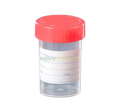Sample Containers With Red Lid Valley Northern