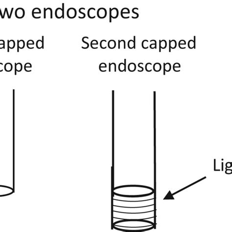 Schematic Drawings Of Two Standard Endoscopes One With A Cap For Band