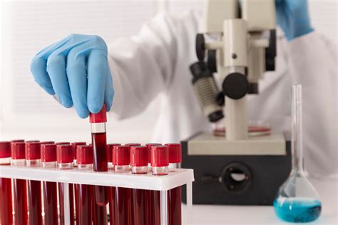 Anemia Prime Med Labs