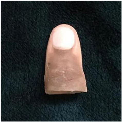 Plastic Left Hand Thumb Prosthesis At Best Price In Mumbai Genesis Silicone House