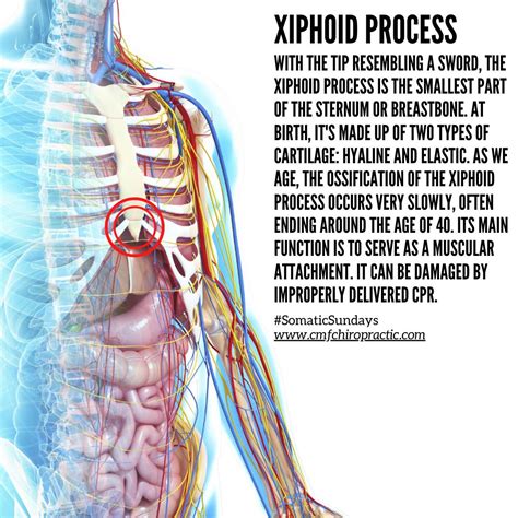 Xiphoid Process Protrusion
