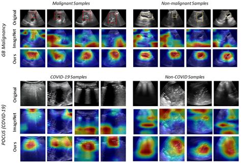 Fig S1 Shows The Grad Cam Visuals Using The Features Generated By The Download Scientific