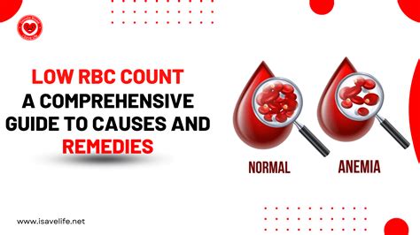 Low Rbc Count A Comprehensive Guide To Causes And Remedies By