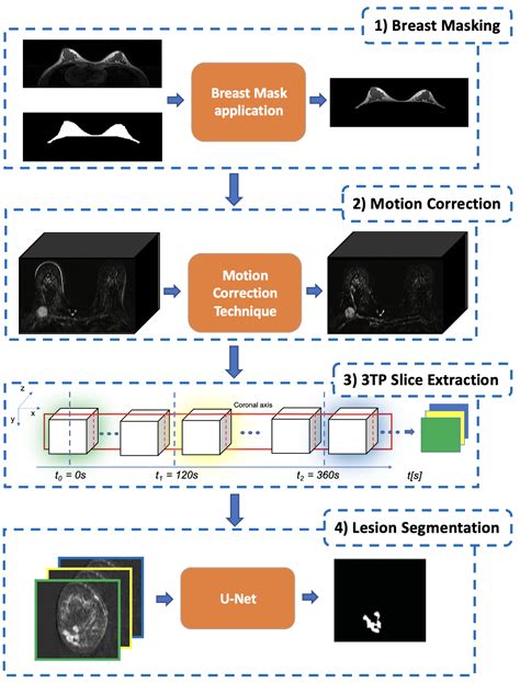 J Imaging Free Full Text A Pipelined Tracer Aware Approach For Lesion Segmentation In