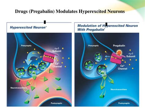 PPT Drugs Pregabalin Modulates Hyperexcited Neurons PowerPoint Presentation ID