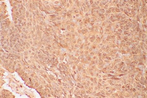 Background Staining Or Non Specific Binding Of Antibodies In Immunohistochemistry Finetest