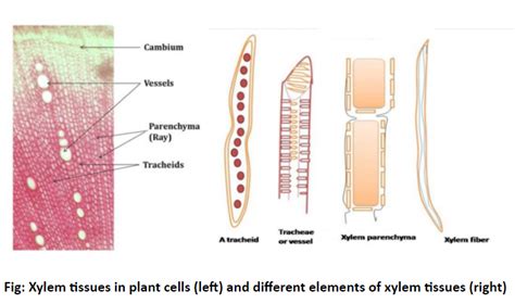 Xylem Parenchyma Diagram