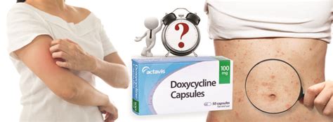 Doxycycline To Work For Bacterial Infections