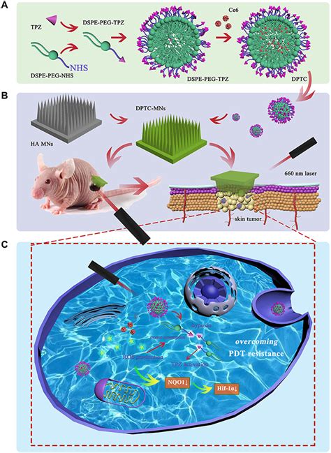 Dissolving Microneedle Based Cascade Activation Nanoplatform Ijn