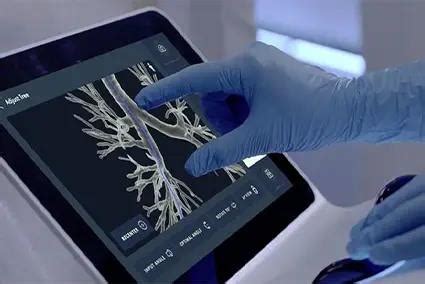 INTERVENTIONAL RADIOLOGY Ekol Hospitals