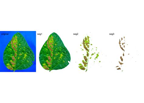 R Package Pliman Phytopathometry
