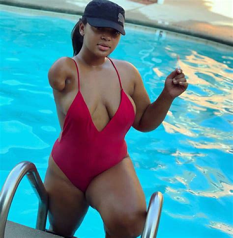 Beautiful Amputee Flaunts Her Stunning Bod In Revealing Bikini Photos Torizone