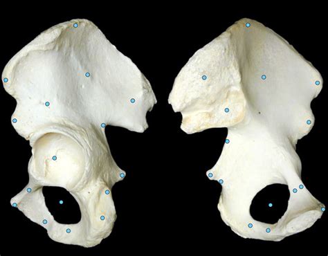 Osa Coxae Terms Medial And Lateral Views Key Definitions Flashcards Quizlet