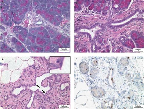 Pancreatic Duct Histology