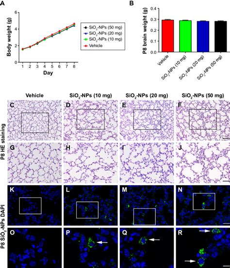 Sio 2 Np Treatment Induced Inflammatory Response In The Lungs Of The