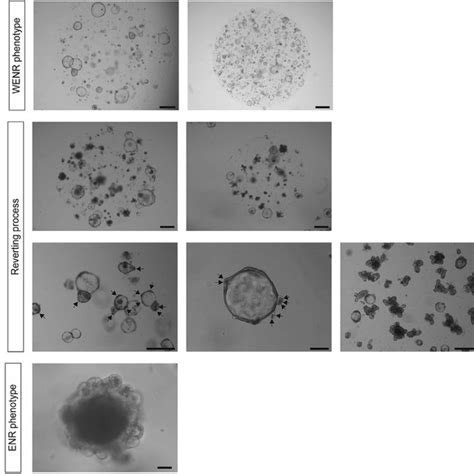 Mouse Small Intestinal Organoids Reverting From A Cyst Like State To A Download Scientific