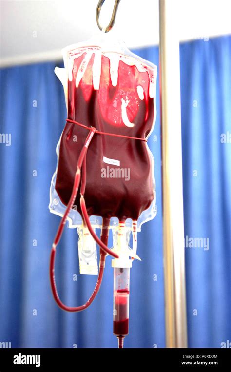 Platelet Transfusion Tubing