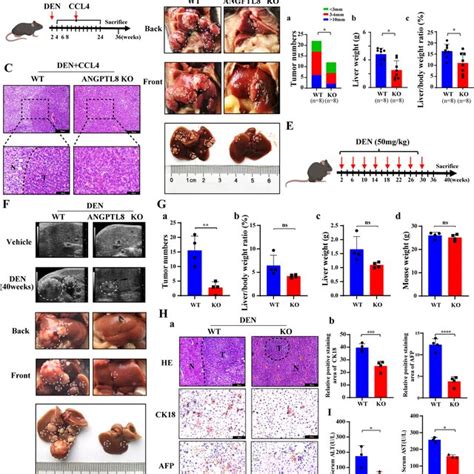 Angptl8 Ko Alleviates The Progression Of Den And Den Plus Ccl4 Induced