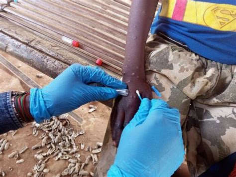 Sex Key To Transmission Killed Over 500 People 6 Things To Know