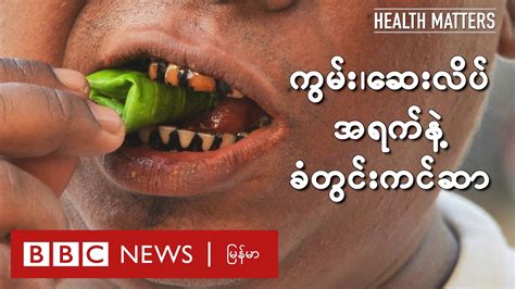 ကွမ်း၊ ဆေးလိပ်၊ အရက်နဲ့ ခံတွင်းကင်ဆာ Bbc News မြန်မာ ပါးစပ်ထဲမှာ အနာ ဒါမှမဟုတ် အဖြူကွက် အနီက