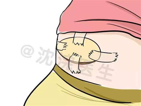 試管嬰兒注射黃體酮產生硬結怎麼辦巧用這種蔬菜簡單又有效 每日頭條