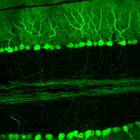 How Are Purkinje Cells In The Cerebellum Linked To Autism Psychology
