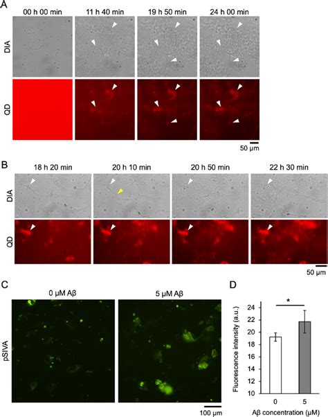 Anchoring Of Endothelial Cells On A Plate Surface By Aβ Aggregates