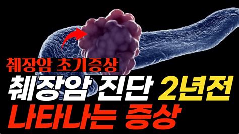 이 증상이 나타나면 췌장 검사 꼭 받으세요 췌장암 초기증상 Youtube