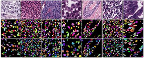Frontiers Nuclear Segmentation In Histopathological Images Using Two Stage Stacked U Nets With